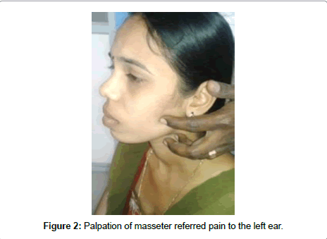 A Novel Case of Orofacial Pain Treated by Dry Needling Technique