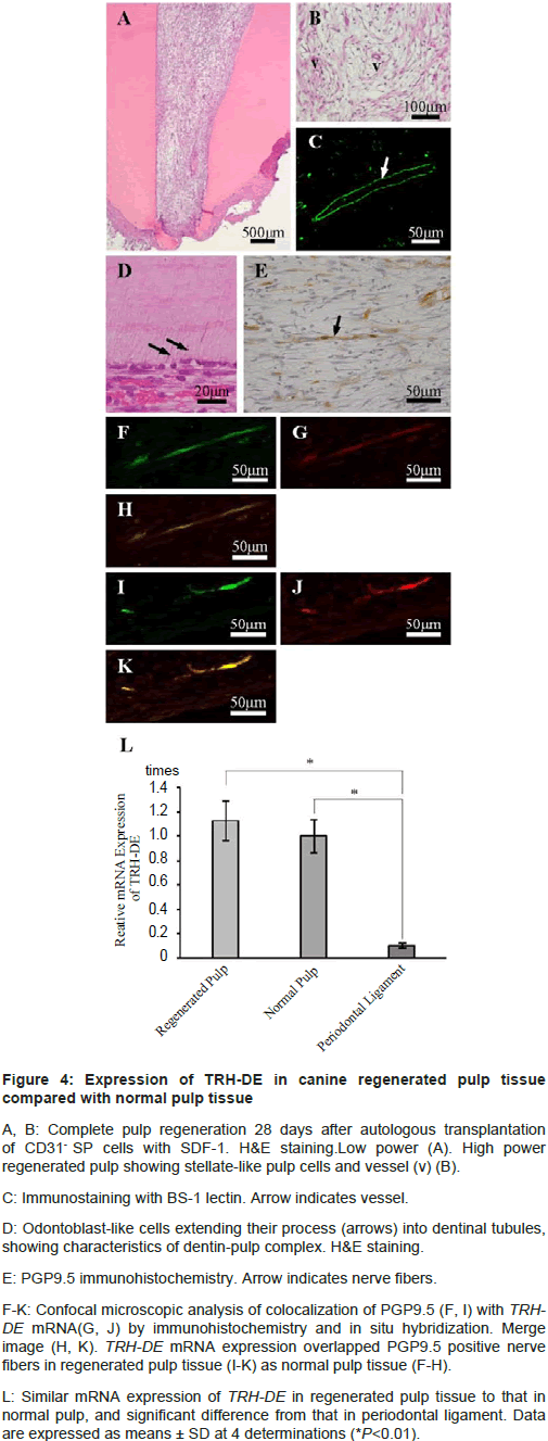 Identification of Thyrotropin-Releasing Hormone (TRH)-Degrading Enzyme ...
