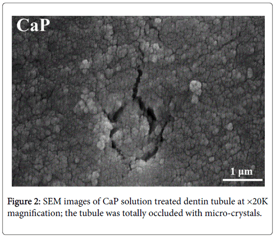 Comparative Efficacy of Experimental Solutions in Occluding Denti