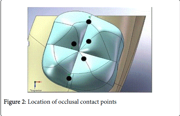 Influence Of Increase Of The Occlusal Contact Area On The Tension ...