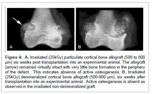 Bone Allografts In Dentistry: A Review
