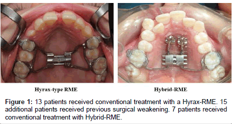 Three-Dimensional Quantification of the Effects between Different