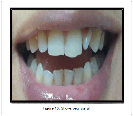 Correction of Facial Esthetics: A Case Series