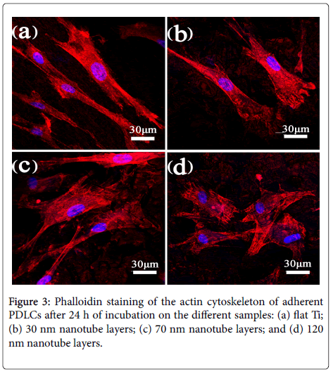 Effect of TiO2 Nanotube Layers Thickness on Periodontal Ligament
