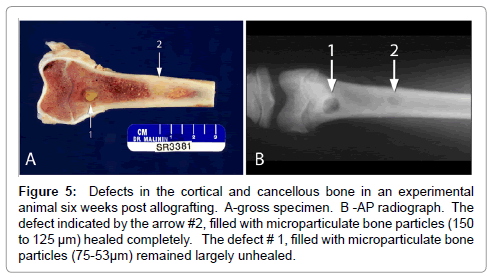 Bone Allografts In Dentistry: A Review