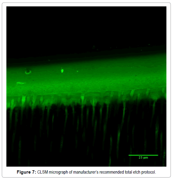 Comparison Of Alternate Protocols For Placing A Sixth Generation Dental ...