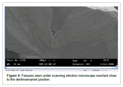 Morphology of Pits and Fissures Reviewed through Scanning Electro