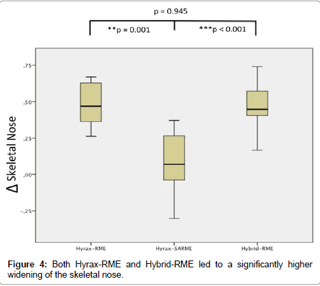 Three-Dimensional Quantification of the Effects between Different