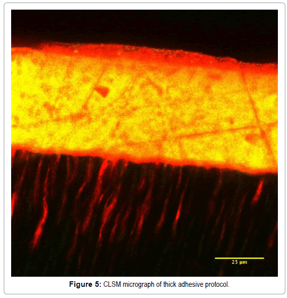Comparison Of Alternate Protocols For Placing A Sixth Generation Dental ...