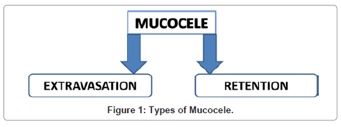Oral Mucocele-A Mini Review