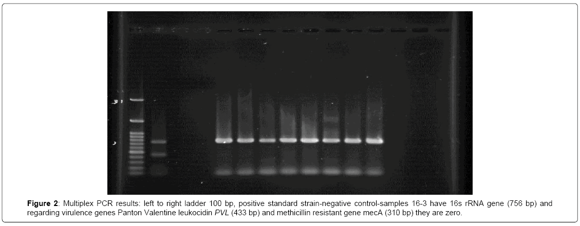 Determining the Presence of Panton-Valentine Leukocidin PVL Virulence ...