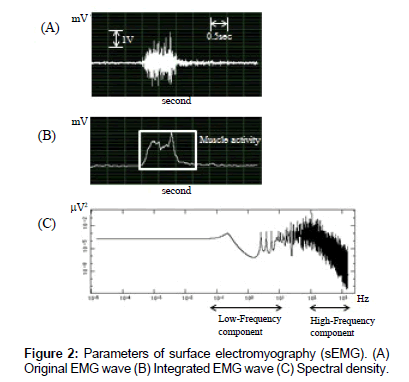 A Predictive Model Based on Surface Electromyography to Assess the ...
