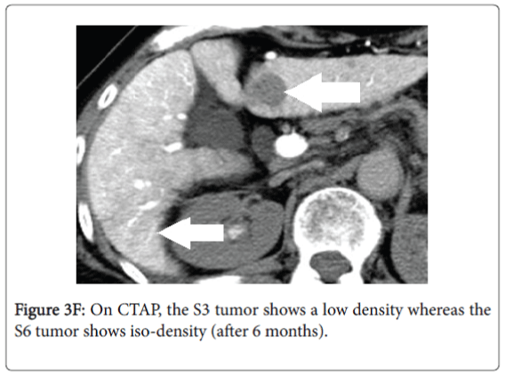 Relationship between the Status of Blood Supply in the Non-hyperv