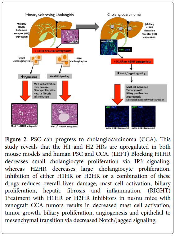 Comprehensive Review of Molecular Mechanisms during Cholestatic Liver ...