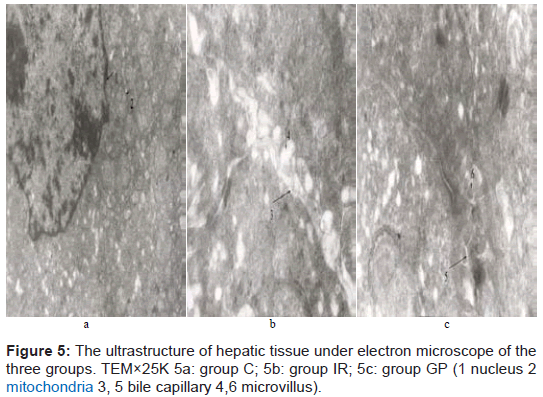 Effects of Ginseng Polysaccharides on Hepatocellular Energy Metab
