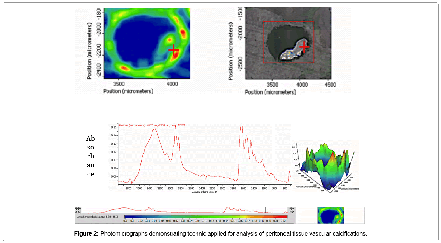 Infrared Microspectroscopy using Synchrotron Radiation (Sr Μft