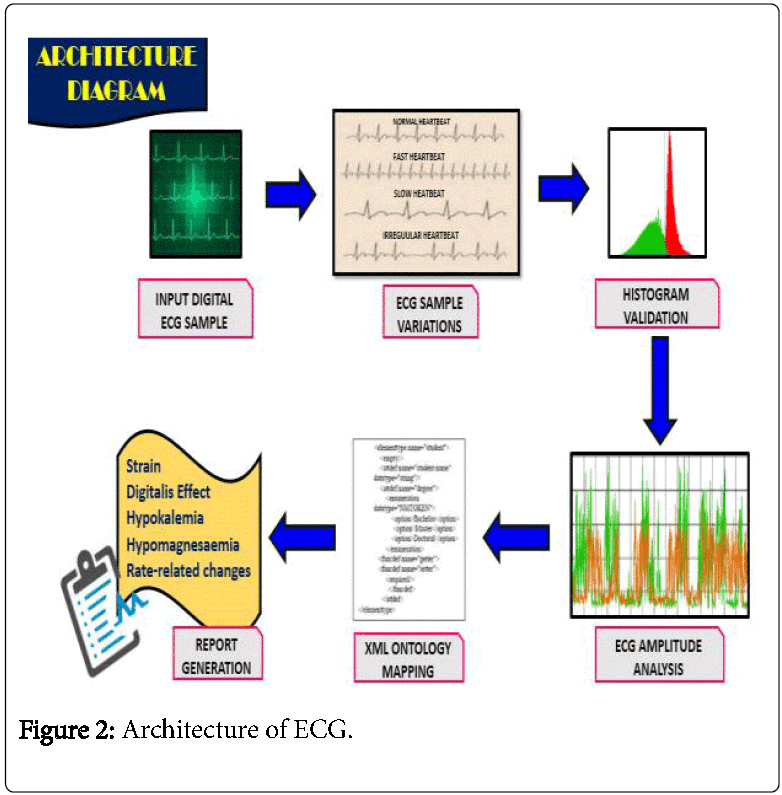 Intelligent Information Extractor through Artificial Data Analyzer ...