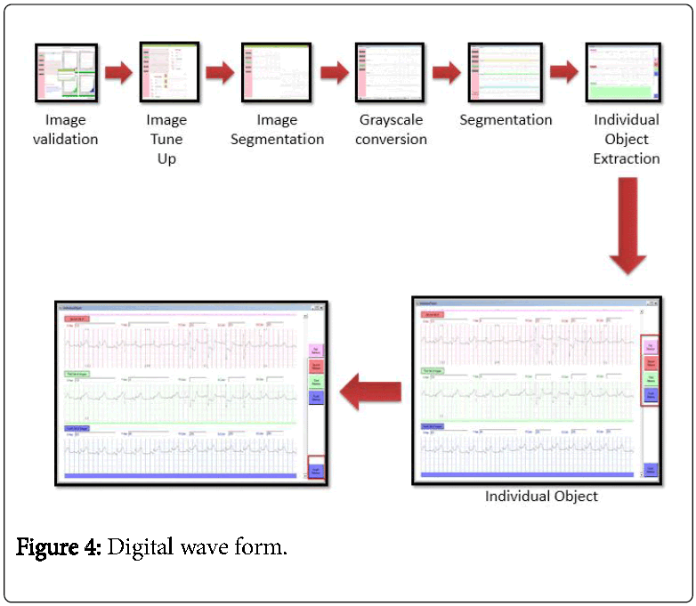 Intelligent Information Extractor through Artificial Data Analyzer ...