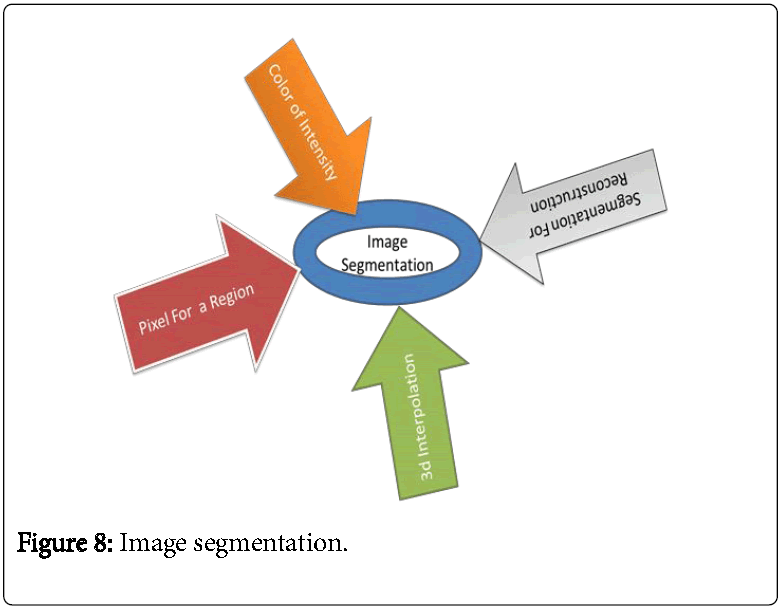 Intelligent Information Extractor through Artificial Data Analyzer ...