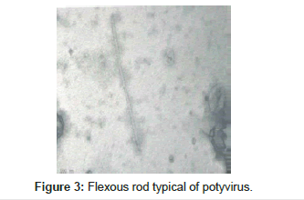 Biological and Molecular Detection of a virus infecting Wedelia t