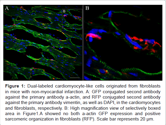 In vivo Direct Reprogramming of Fibroblasts into Cardiomyocyte-Li