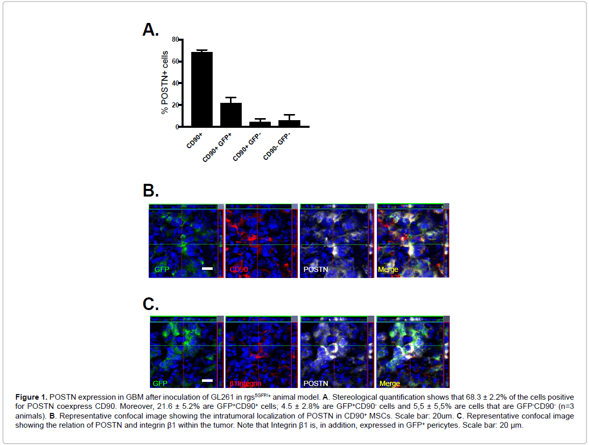 Periostin is Secreted by Glioblastoma CD90-positive Stromal Cells and ...