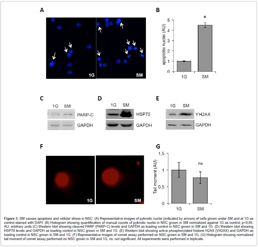 Consequences of Simulated Microgravity in Neural Stem Cells: Biol