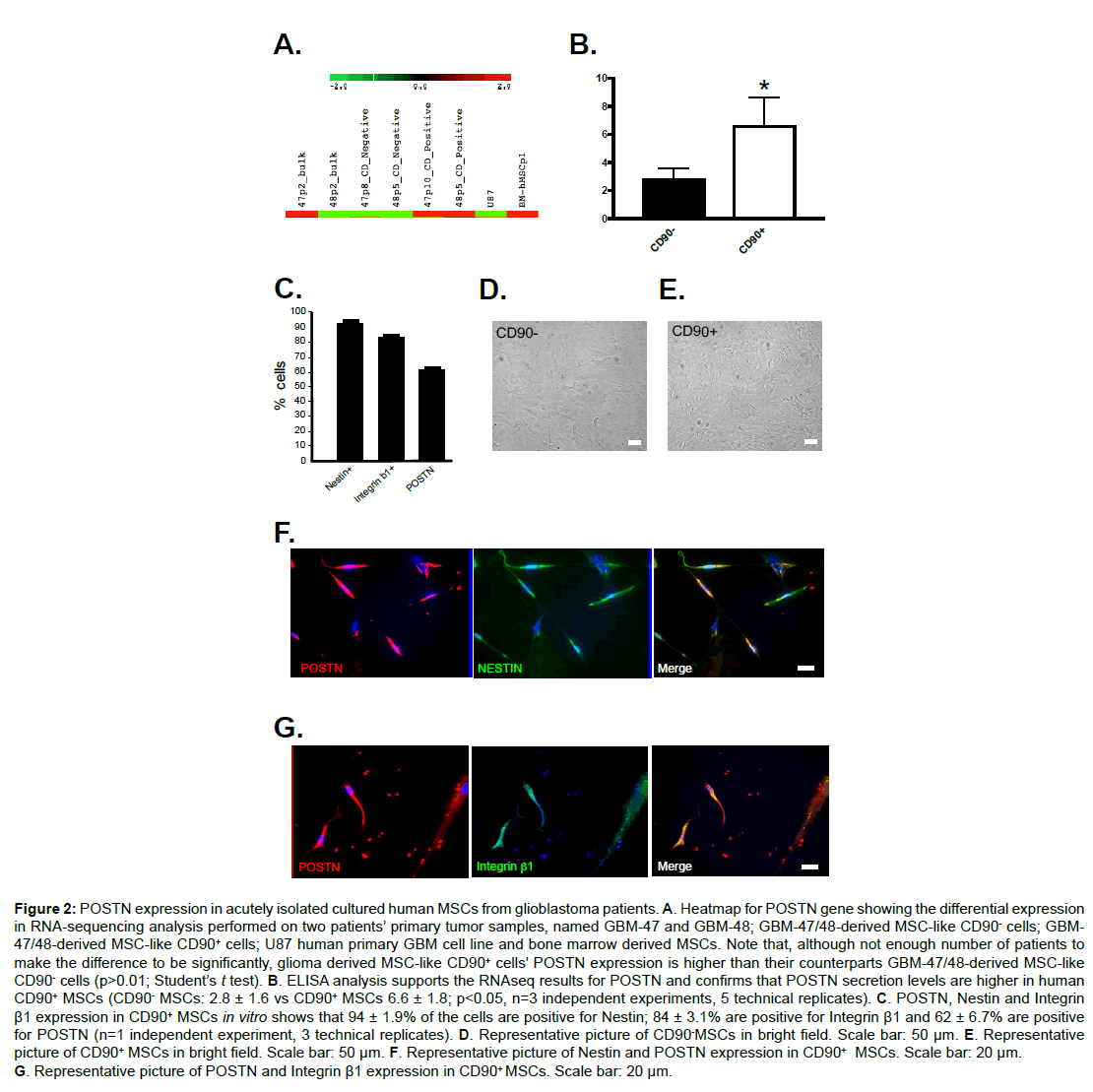 Periostin is Secreted by Glioblastoma CD90-positive Stromal Cells and ...