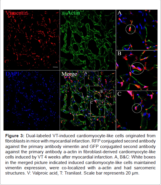In vivo Direct Reprogramming of Fibroblasts into Cardiomyocyte-Li