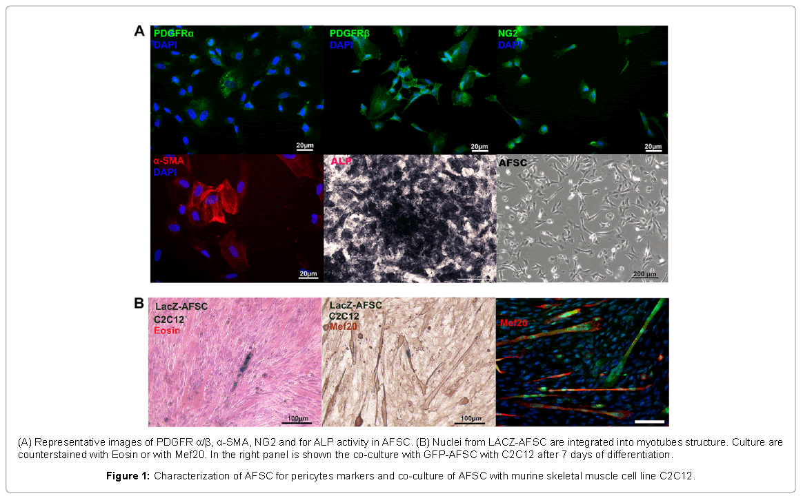 Human Amniotic Fluid Stem Cells Modulate Muscle Regeneration Afte