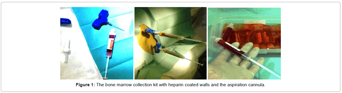 How to Maximize the Success of Stem Cell Autografts for Neuroregeneration