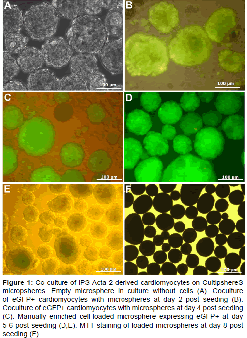 Gelatine Microspheres Support Direct Intramyocardial Delivery of ...