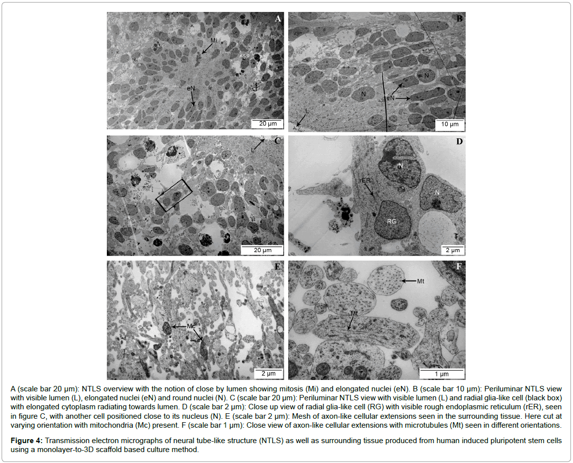 Structural Analysis of Three-dimensional Human Neural Tissue deri