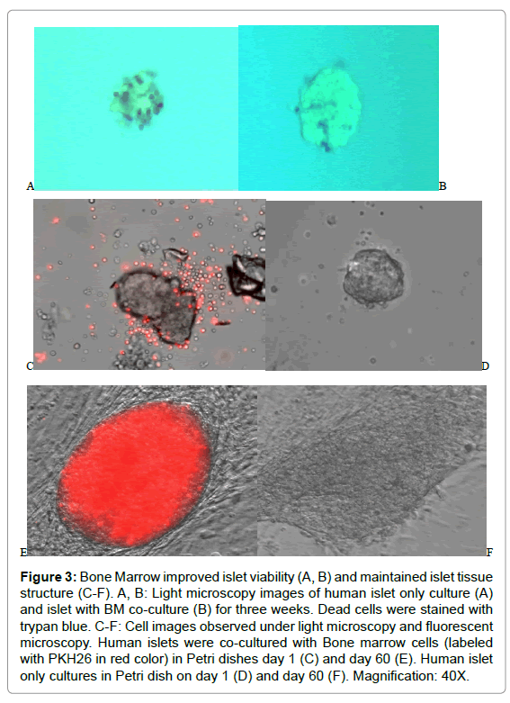 Anti-apoptotic Effects of Bone Marrow on Human Islets: A Prelimin
