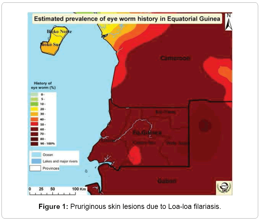 Antiretroviral and Antiparasitic Therapy Management in an Expatriate ...