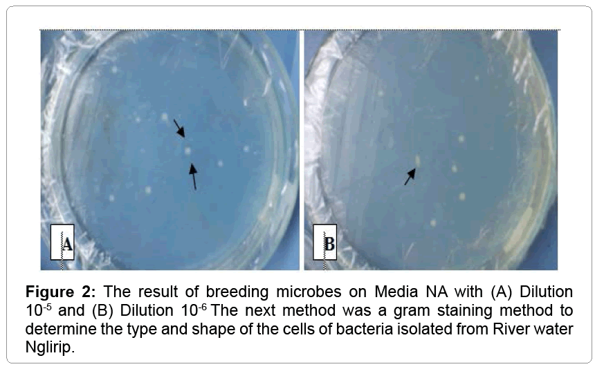 The Identification of Microbial Characteristics and Number of Colonies ...