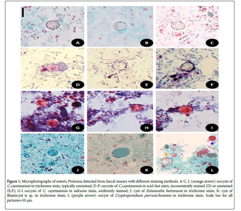Incidental Detection of Cyclospora Cayetanensis during General Health ...