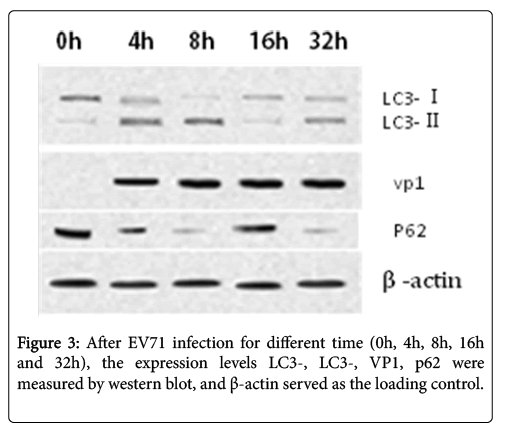 Characteristics of Autophagy Induced by Enterovirus71 (EV71) Viral Protein
