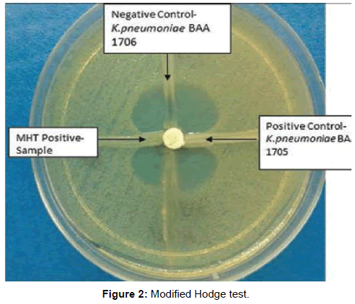 Clinical Importance of Carbapenemase Production in Gram-Negative Bacteria