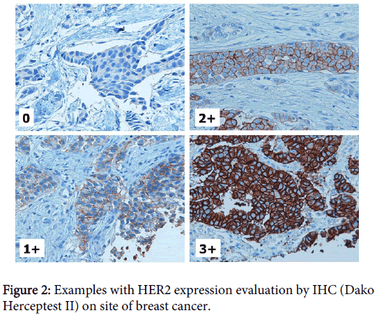 The Effect of Peptide Treatment on the HLA-Binding and Antibody P
