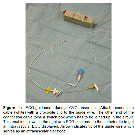 Towards Optimal Central Venous Catheter Tip Position