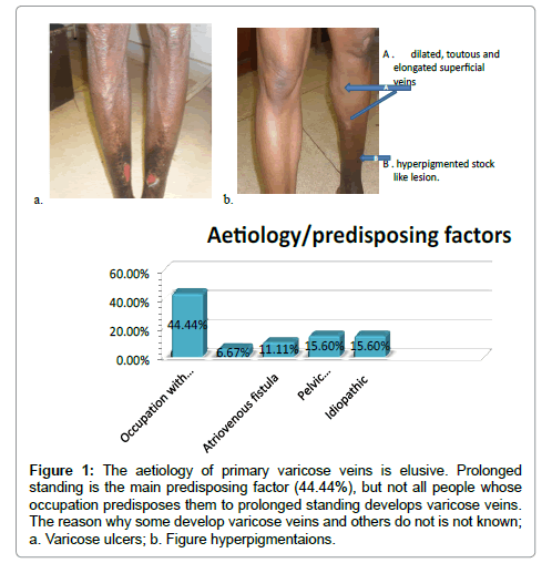 Management of Varicose Veins of the Lower Extremities: A 10-year